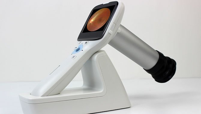 Non Mydriatic Fundus Camera - Competitive Distributor Price