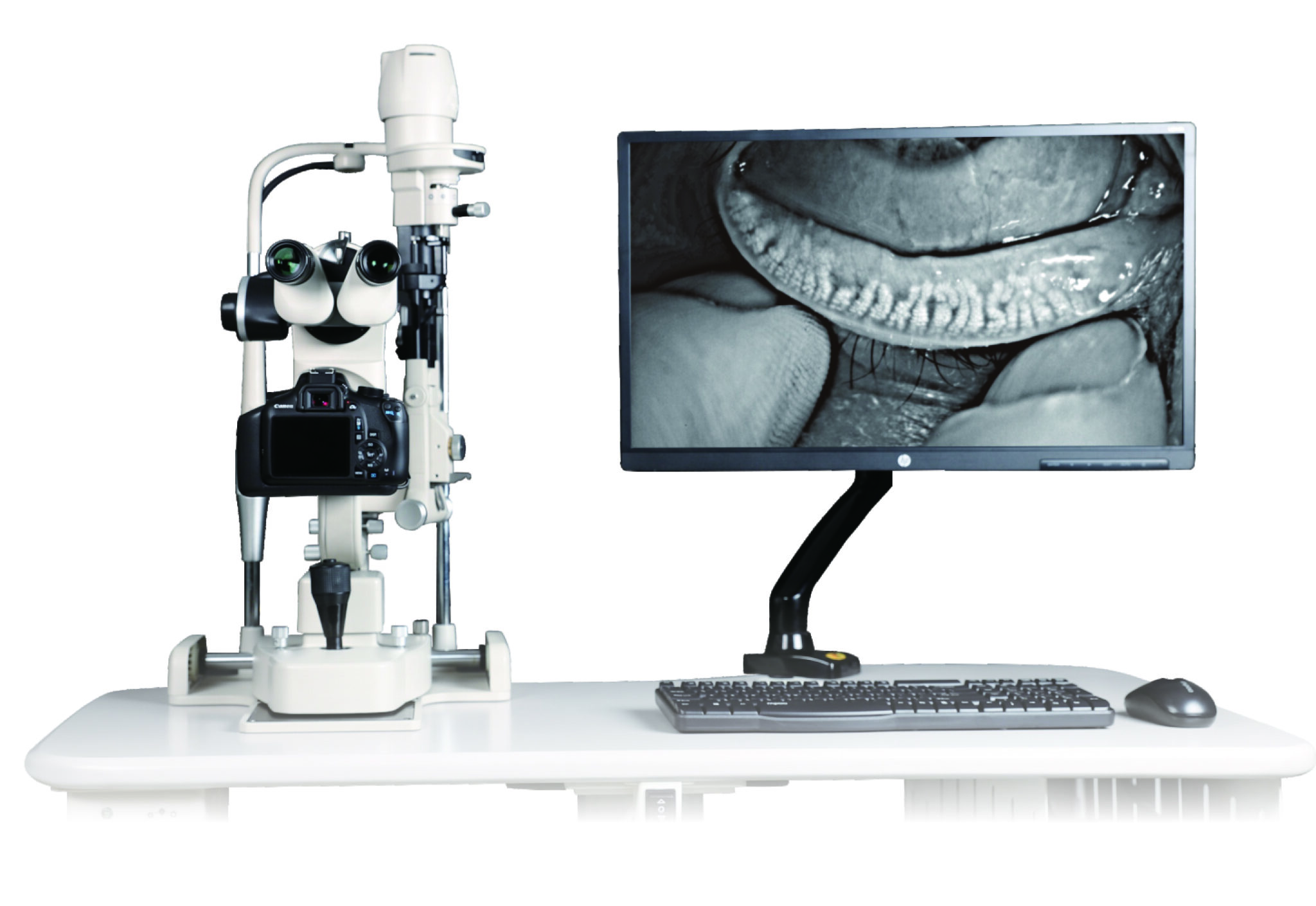 Slit Lamp For Dry Eye Exam - Factory Price