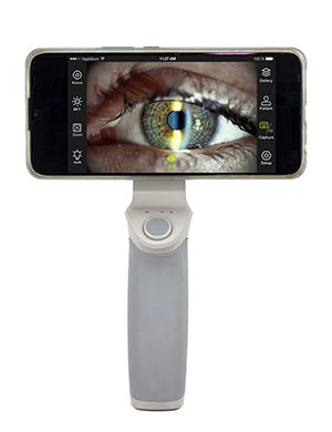 Hand Held Slit Lamp Manufacturer - Competitive Price