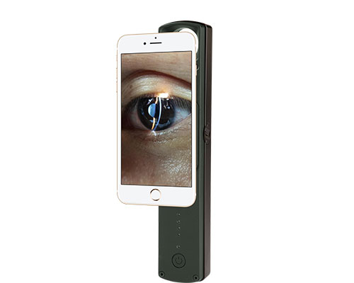 Portable Slit Lamp For Huam Eyes And Veterinary