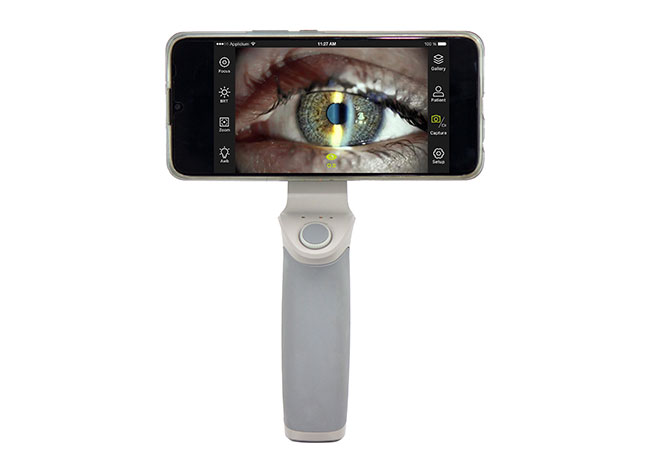 Portable Slit Lamp For Huam Eyes And Veterinary